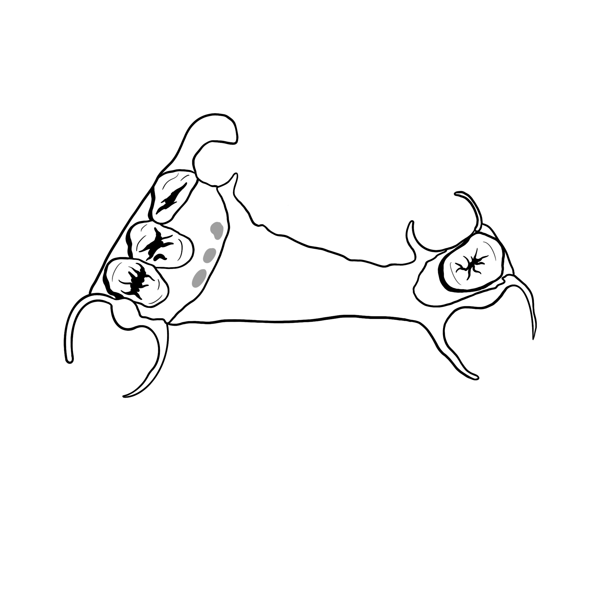 SLM Titanium Partial Dentures